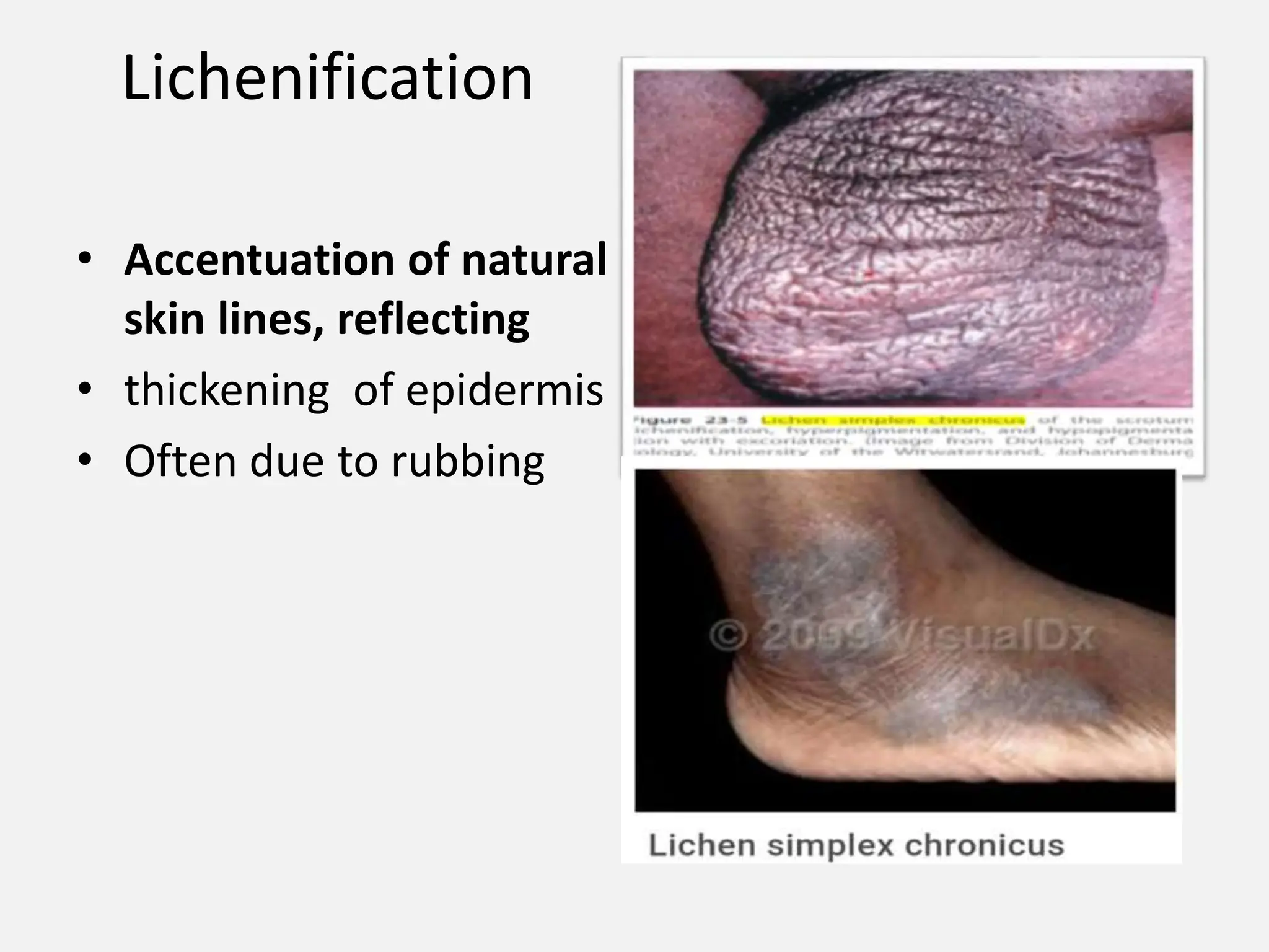 fundamentals of dermatology HO final.pptx | Skin and Dermatology ...
