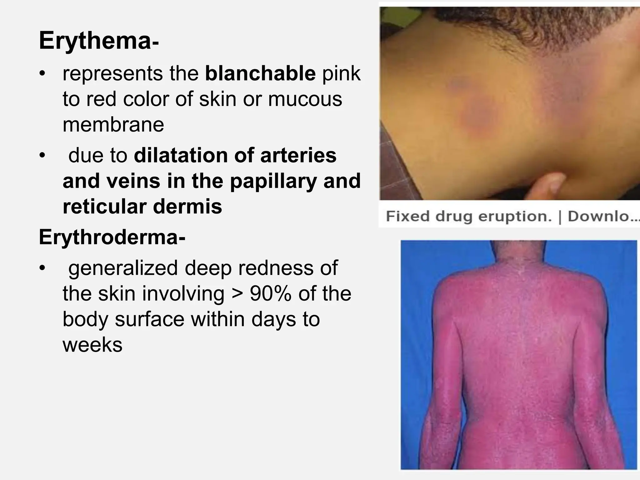 fundamentals of dermatology HO final.pptx | Skin and Dermatology ...