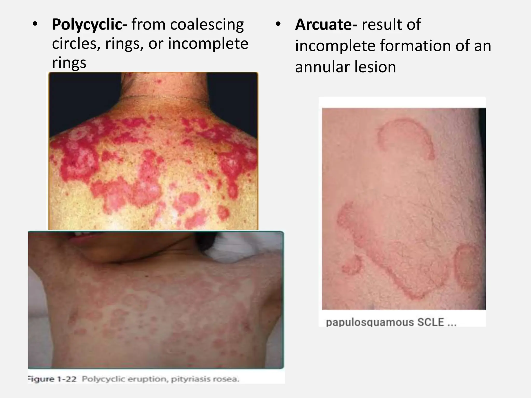 fundamentals of dermatology HO final.pptx | Skin and Dermatology ...