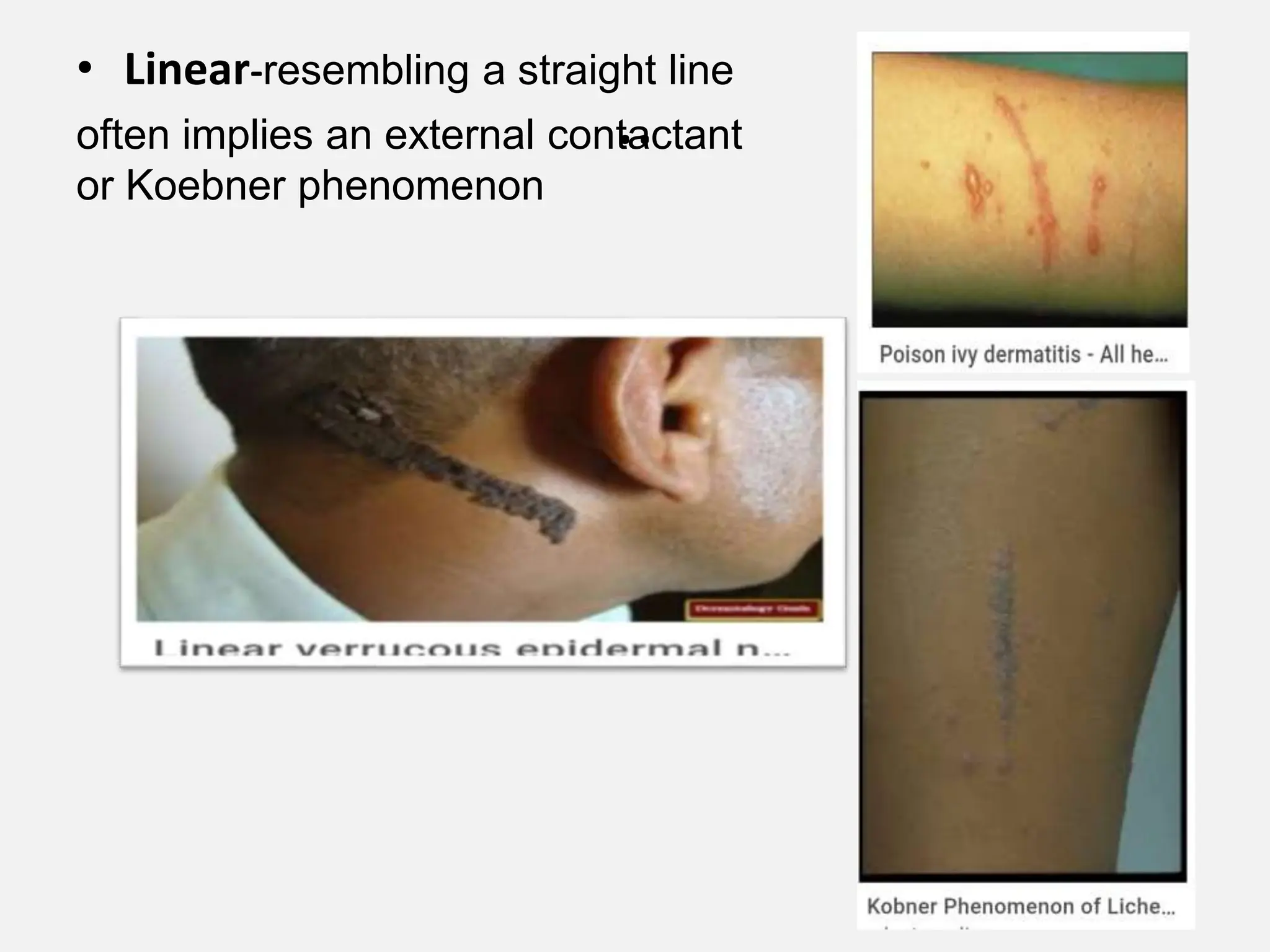fundamentals of dermatology HO final.pptx | Skin and Dermatology ...