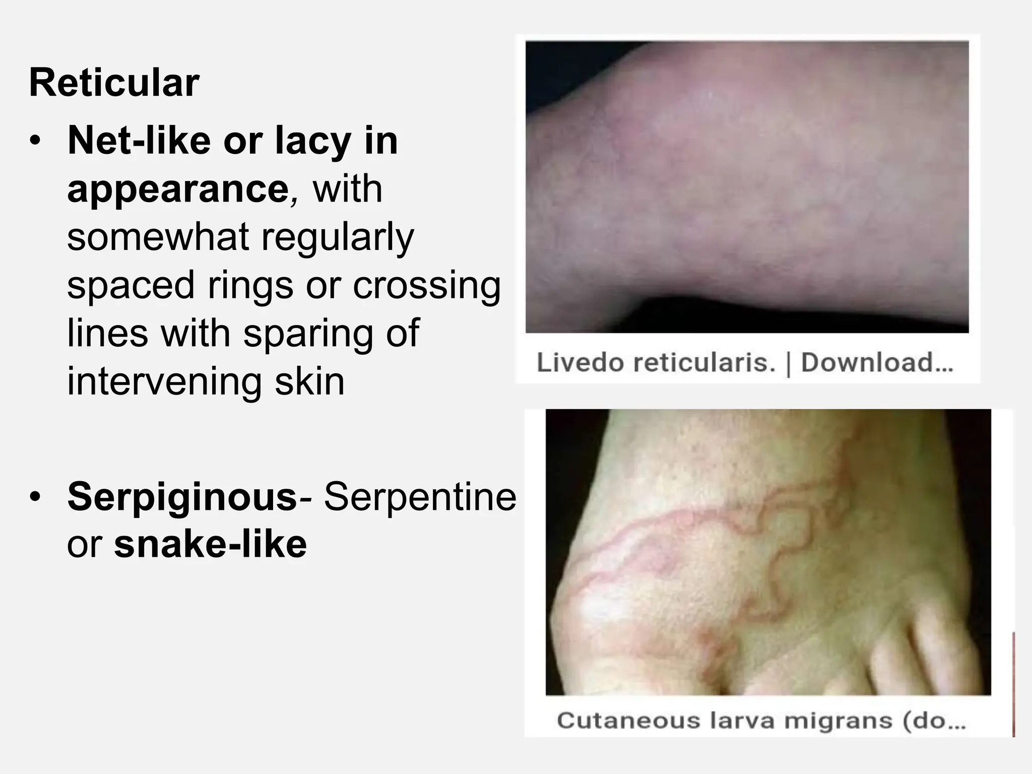 fundamentals of dermatology HO final.pptx | Skin and Dermatology ...