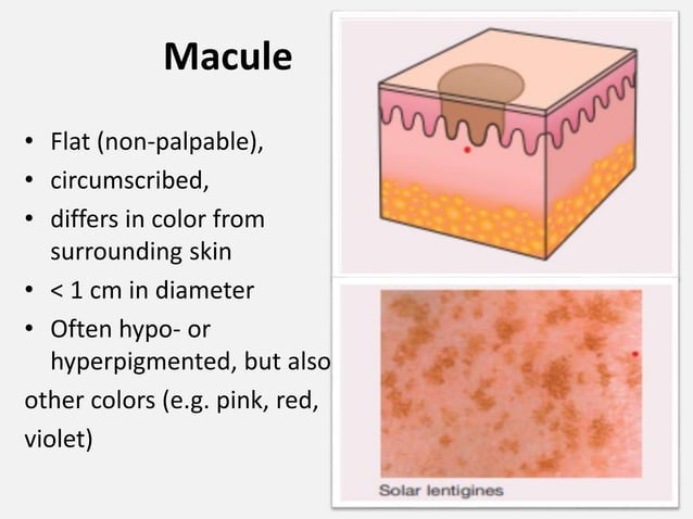 fundamentals of dermatology HO final.pptx | Skin and Dermatology ...