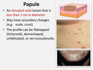 fundamentals of dermatology HO final.pptx