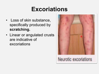 fundamentals of dermatology HO final.pptx
