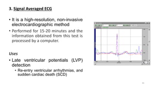 Fundamentals of Electrocardiography | PPTX