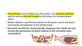 FUNDAMENTALS OF LAPAROSCOPIC AND ROBOTIC UROLOGIC SURGERY.pptx