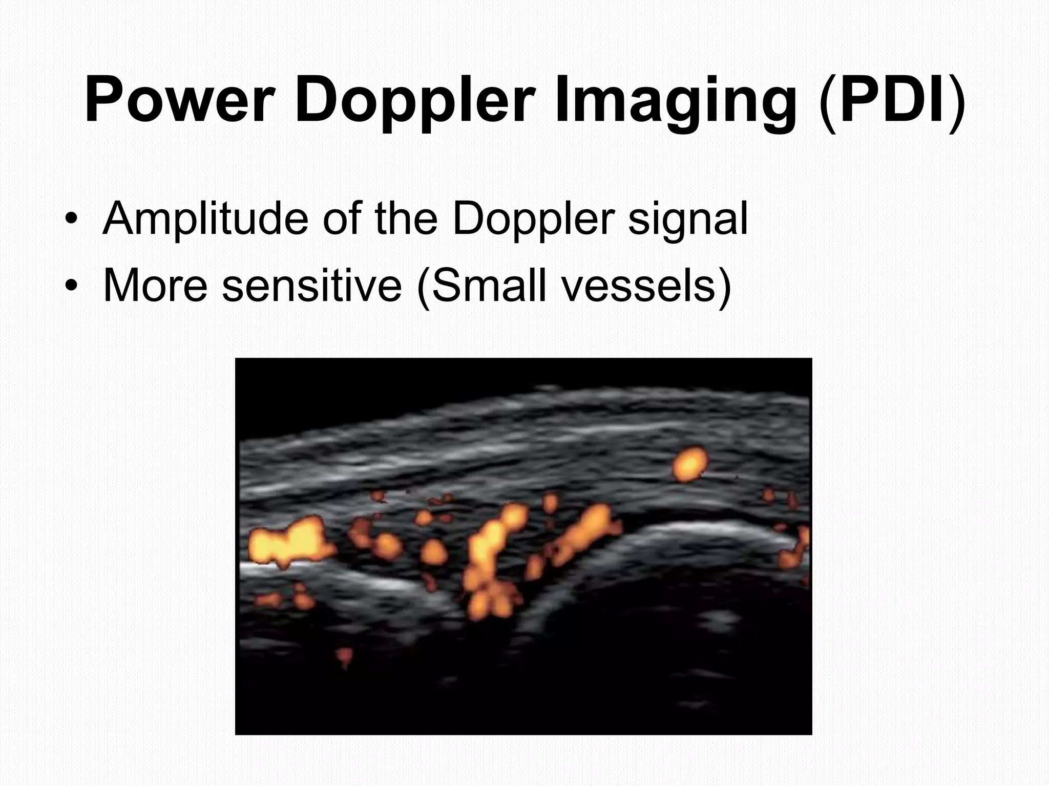 Fundamentals of musculoskeletal ultrasound | PPTX