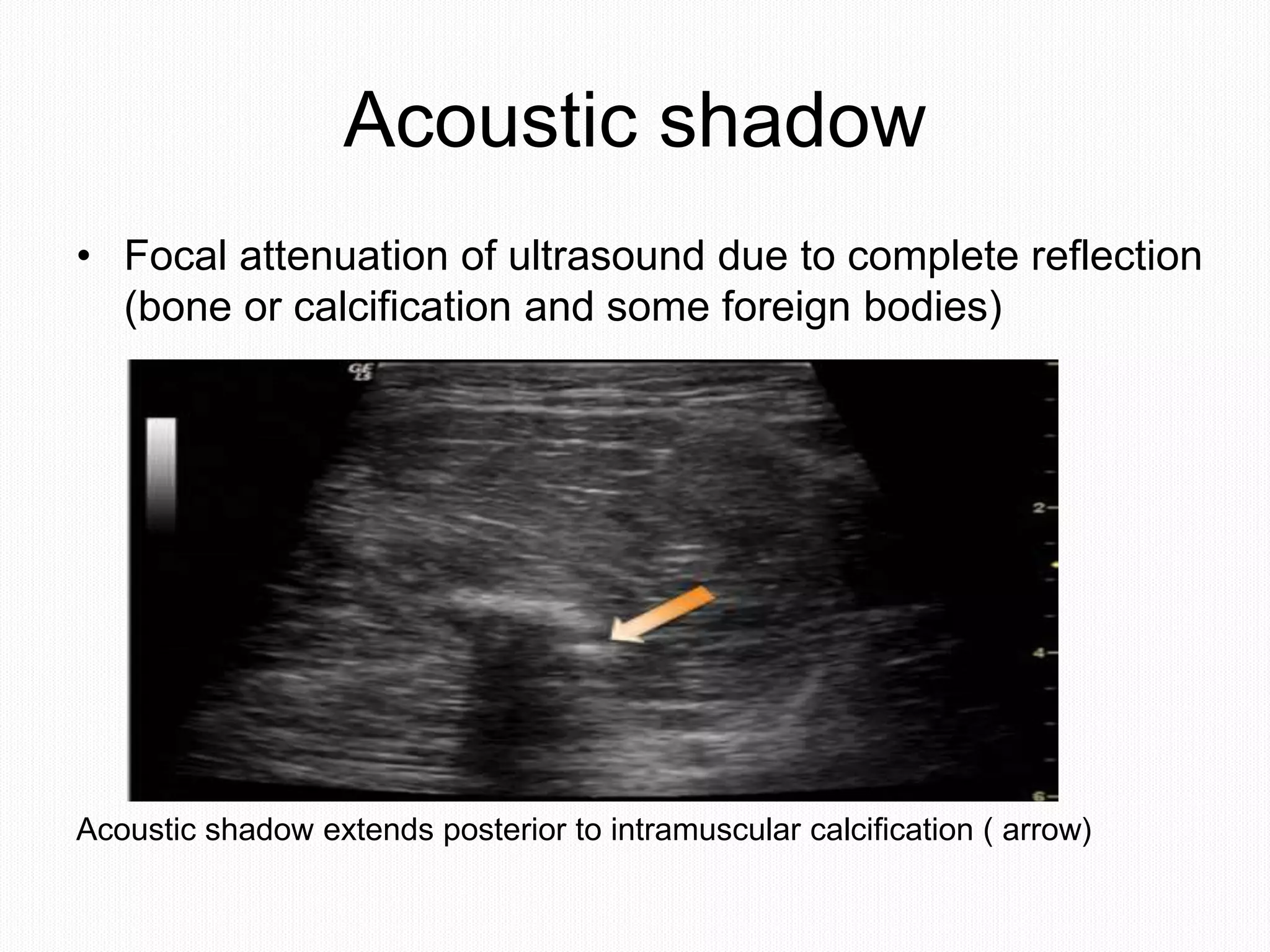 Fundamentals of musculoskeletal ultrasound | PPTX