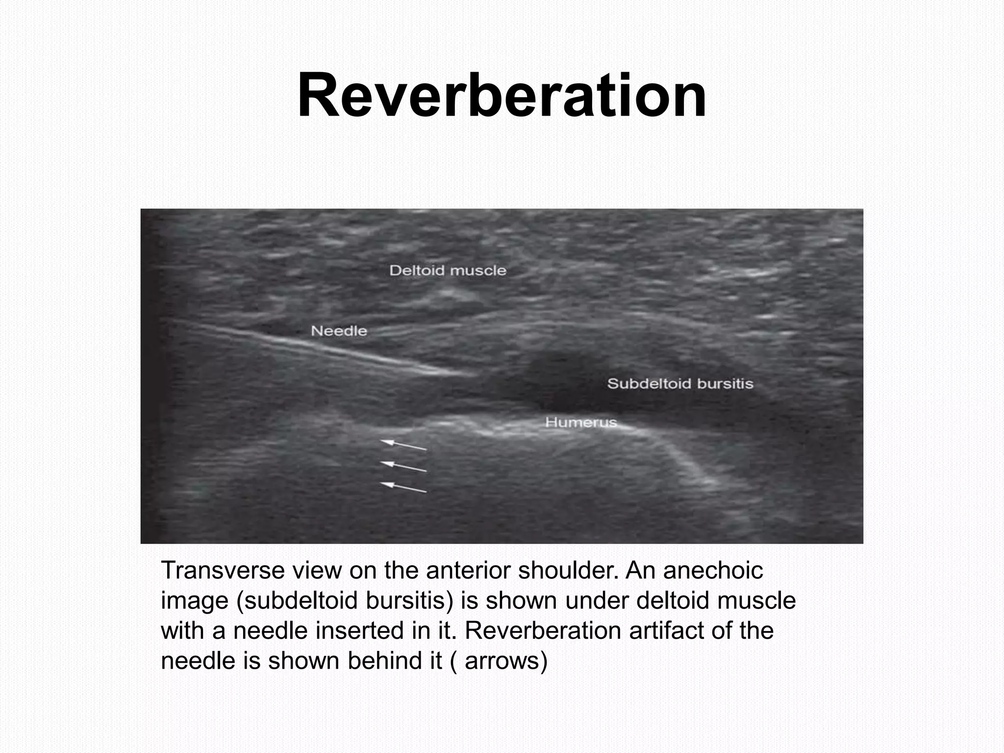 Fundamentals of musculoskeletal ultrasound | PPTX