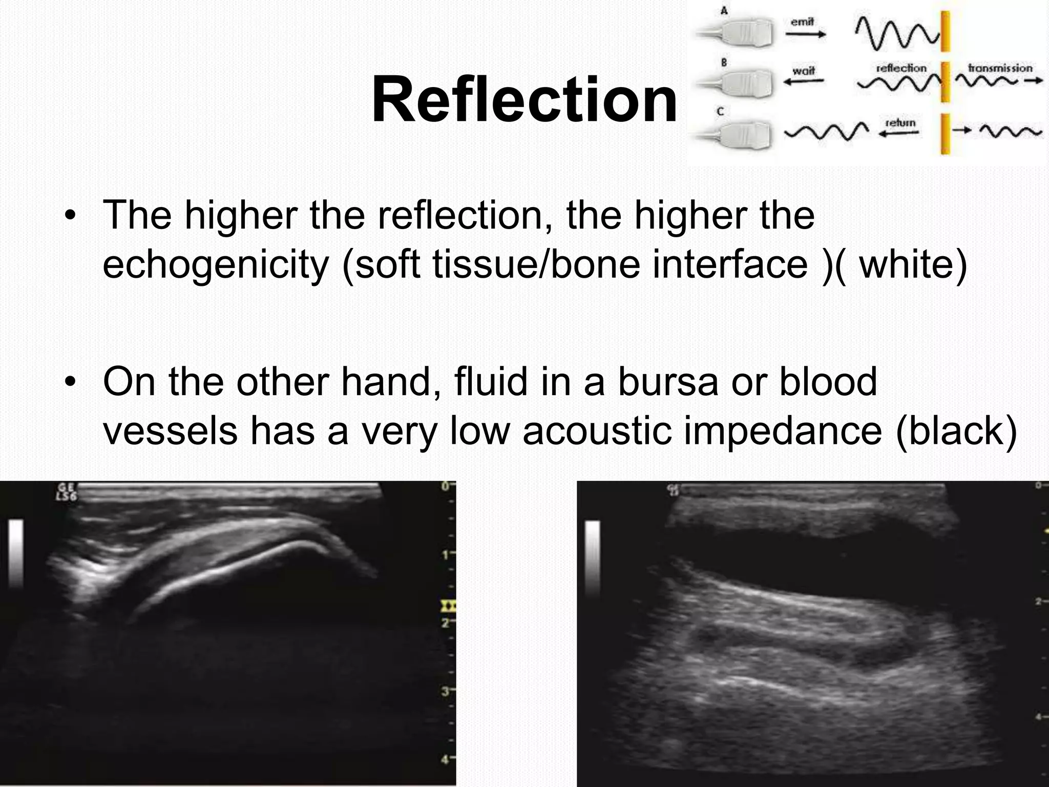 Fundamentals of musculoskeletal ultrasound | PPTX
