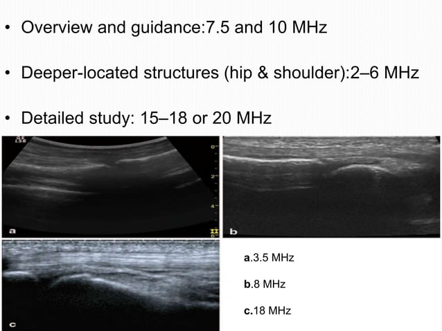 Fundamentals of musculoskeletal ultrasound | PPTX | Medical Tests ...