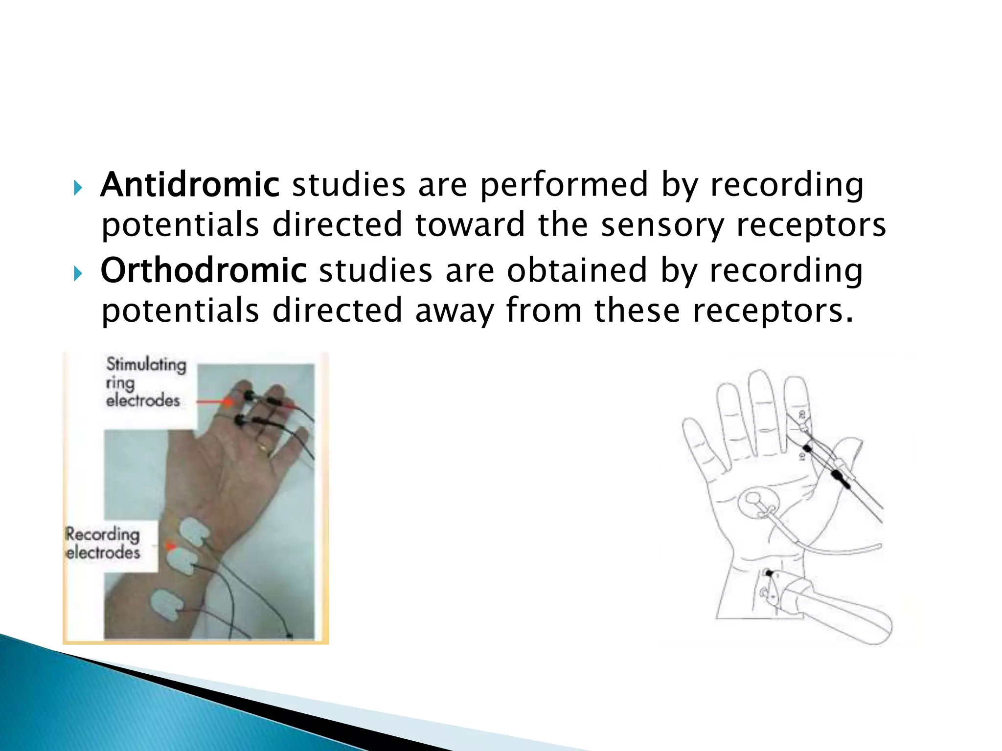 Fundamentals of nerve conduction study | PPTX