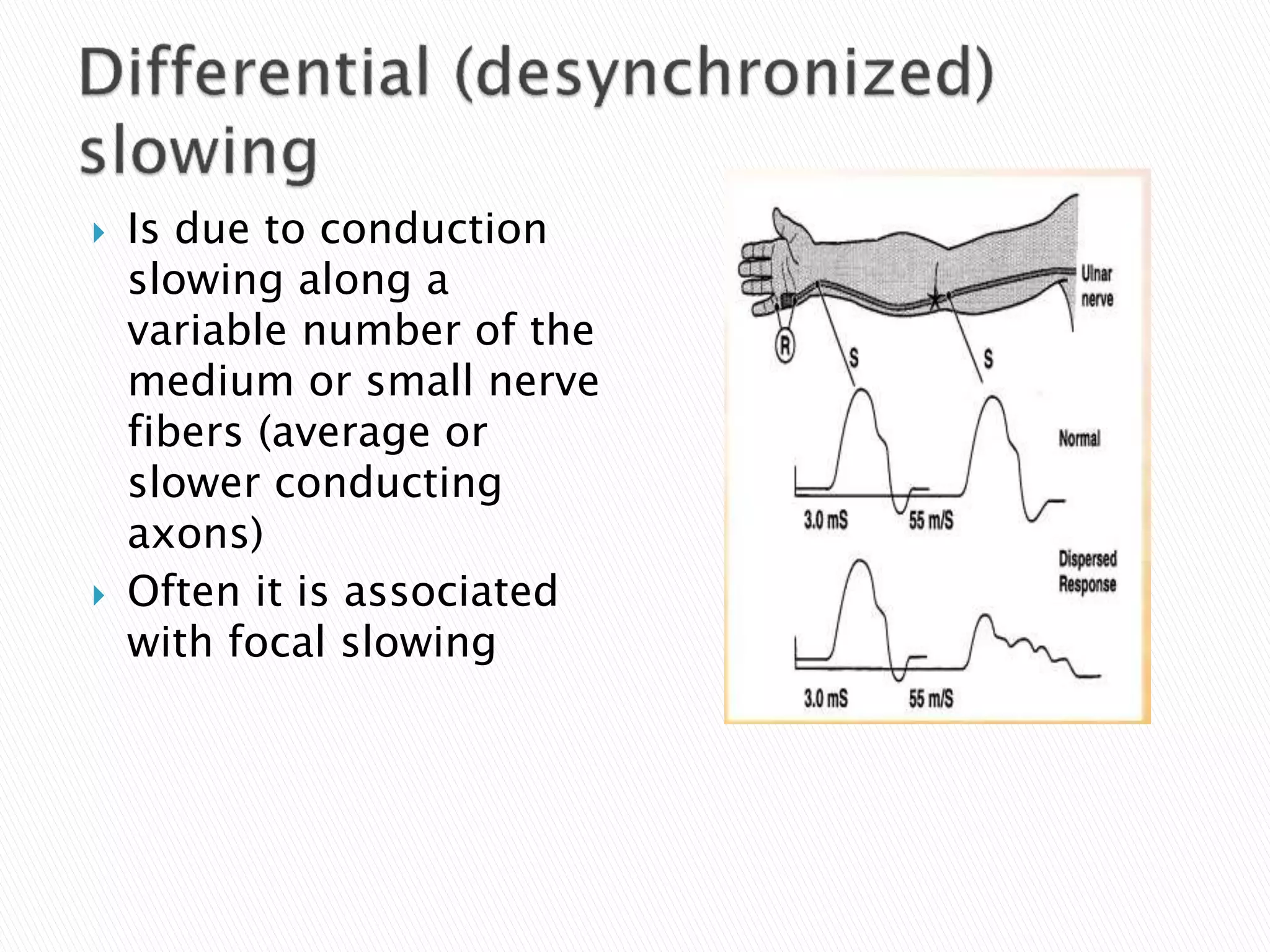Fundamentals of nerve conduction study | PPTX