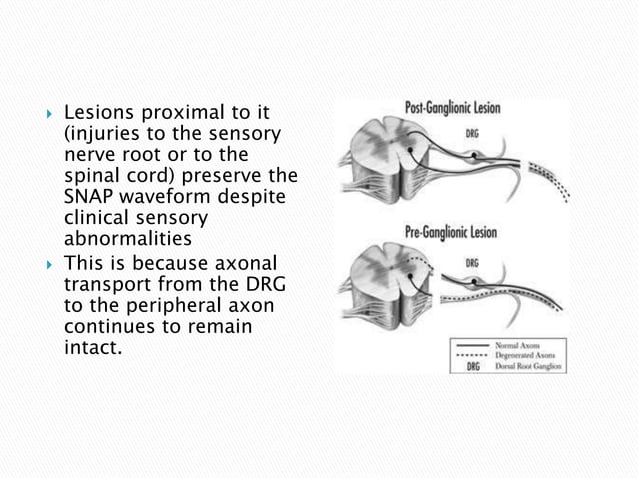 Fundamentals of nerve conduction study | PPTX