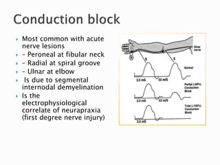 Fundamentals of nerve conduction study | PPTX