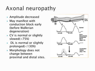 Fundamentals of nerve conduction study | PPTX