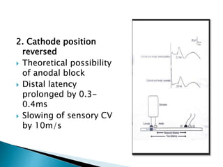 Fundamentals of nerve conduction study | PPTX