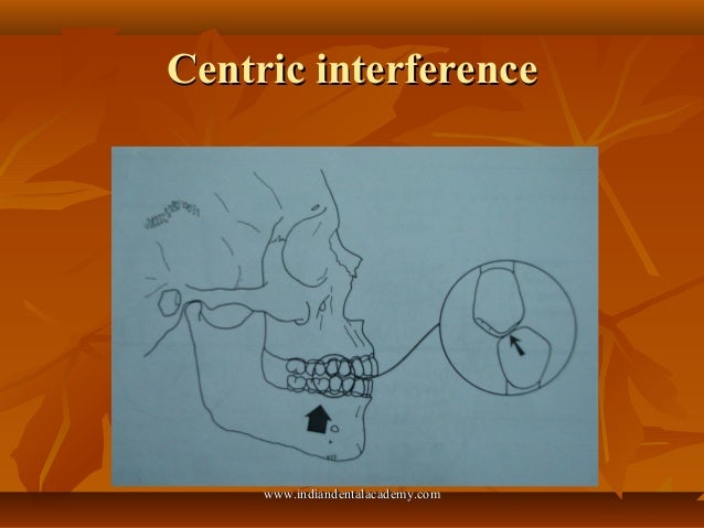 Fundamentals of occlusion/ cosmetic dentistry training