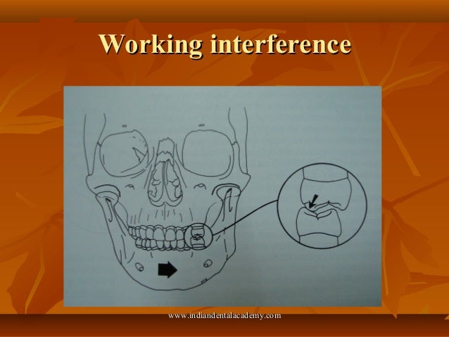 Fundamentals of occlusion/ cosmetic dentistry training