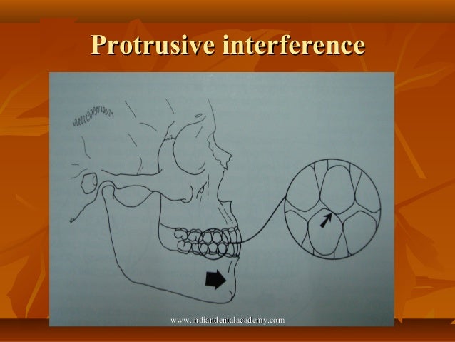 Fundamentals of occlusion/ cosmetic dentistry training