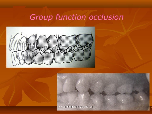 Fundamentals of occlusion/ cosmetic dentistry training