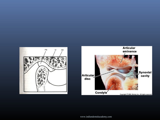 Fundamentals of occlusion/cosmetic dentistry courses | PPT | Dental ...