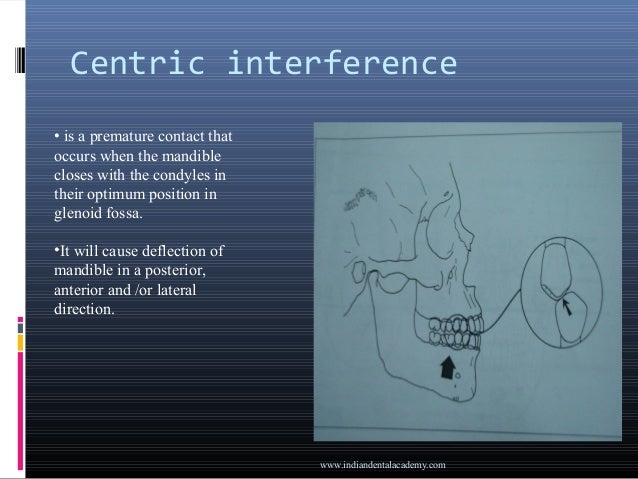 Fundamentals of occlusion/cosmetic dentistry courses
