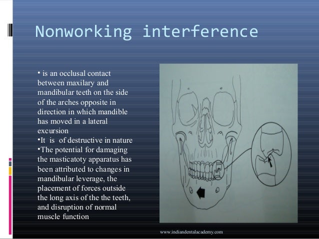 Fundamentals of occlusion/cosmetic dentistry courses