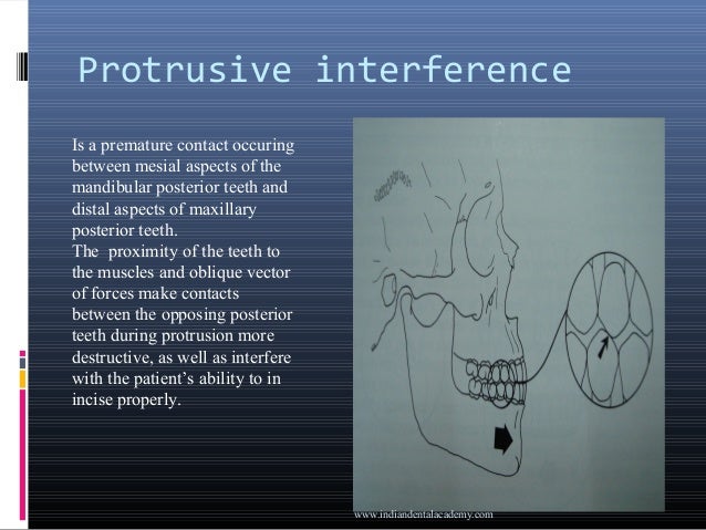 Fundamentals of occlusion/cosmetic dentistry courses