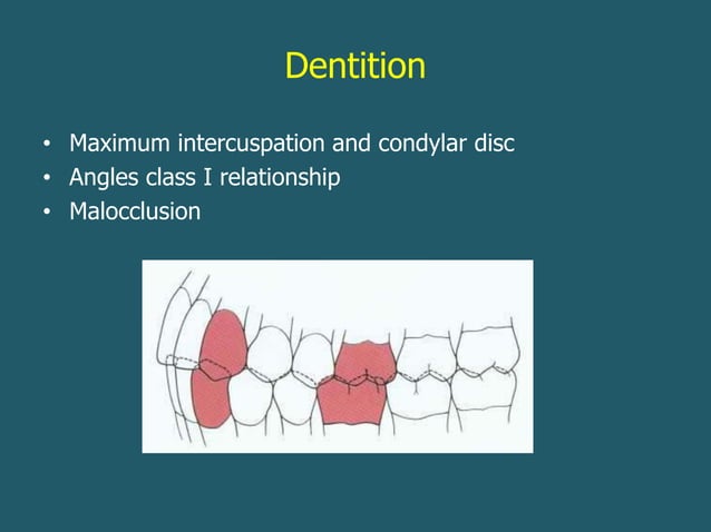 fundamentals of occlusion.pptx | Dental Health | Diseases and Conditions