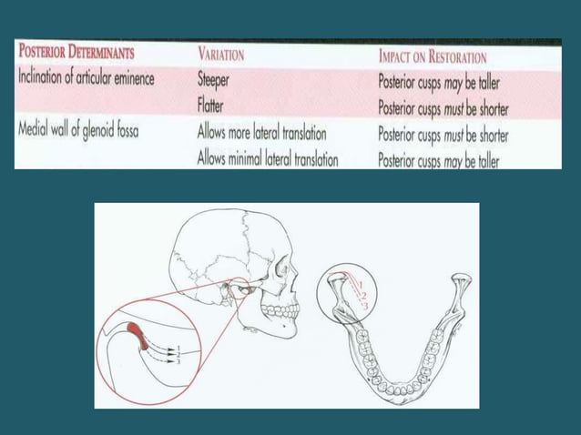 fundamentals of occlusion.pptx | Dental Health | Diseases and Conditions