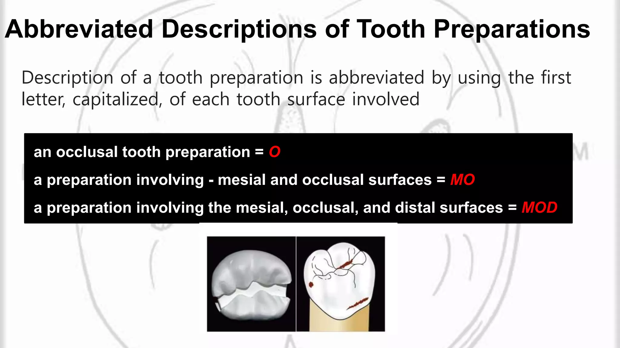 Fundamentals of Cavity preparation | PPTX