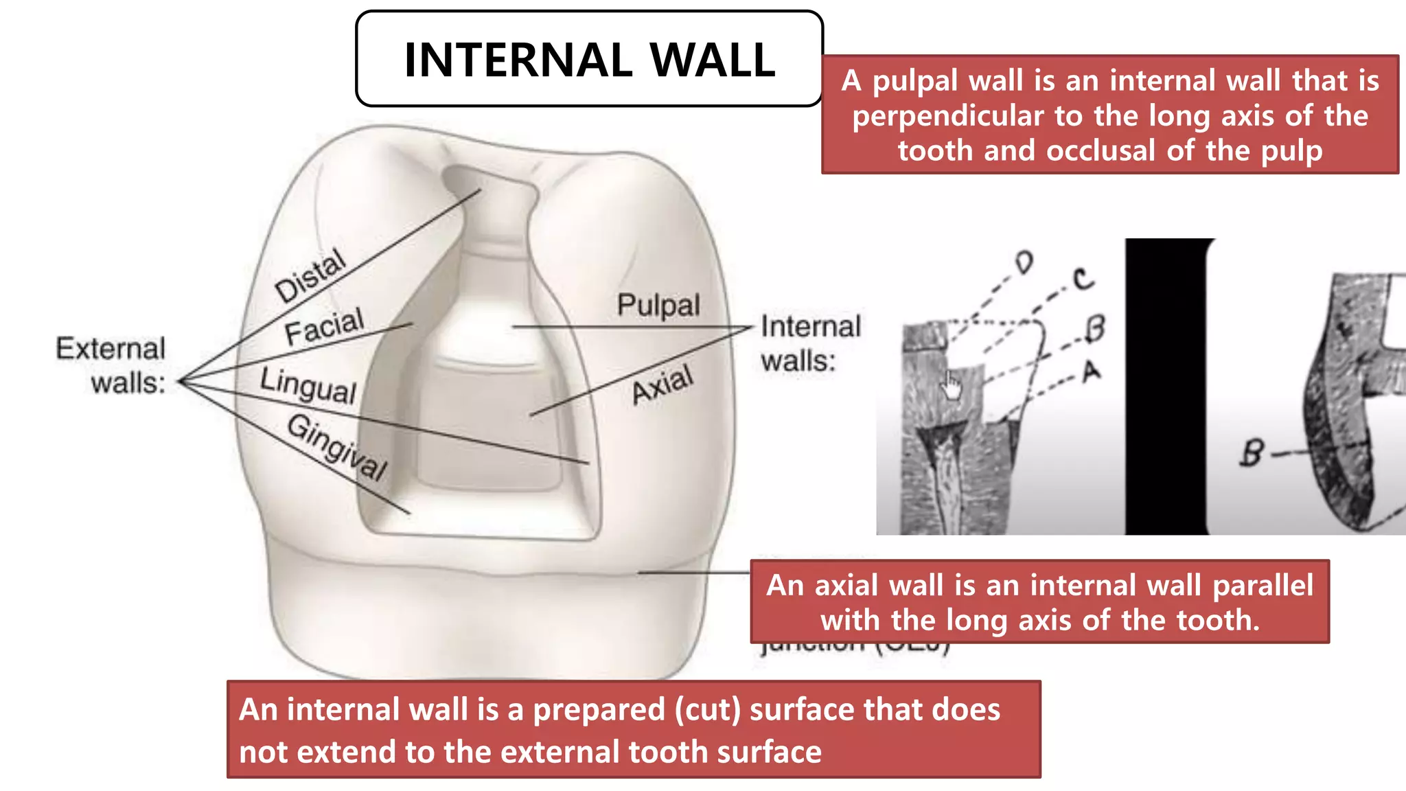 Fundamentals of Cavity preparation | PPTX