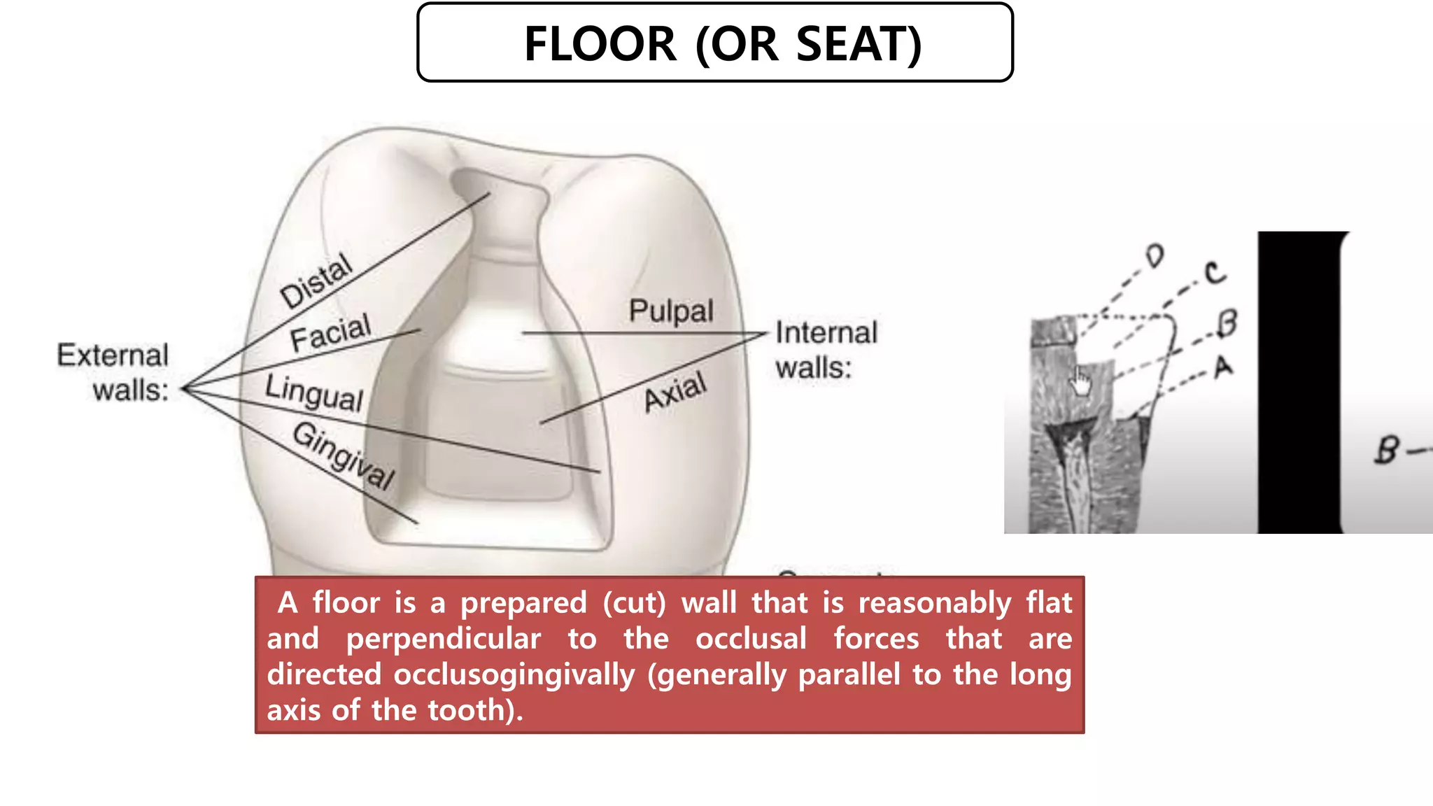 Fundamentals of Cavity preparation | PPTX