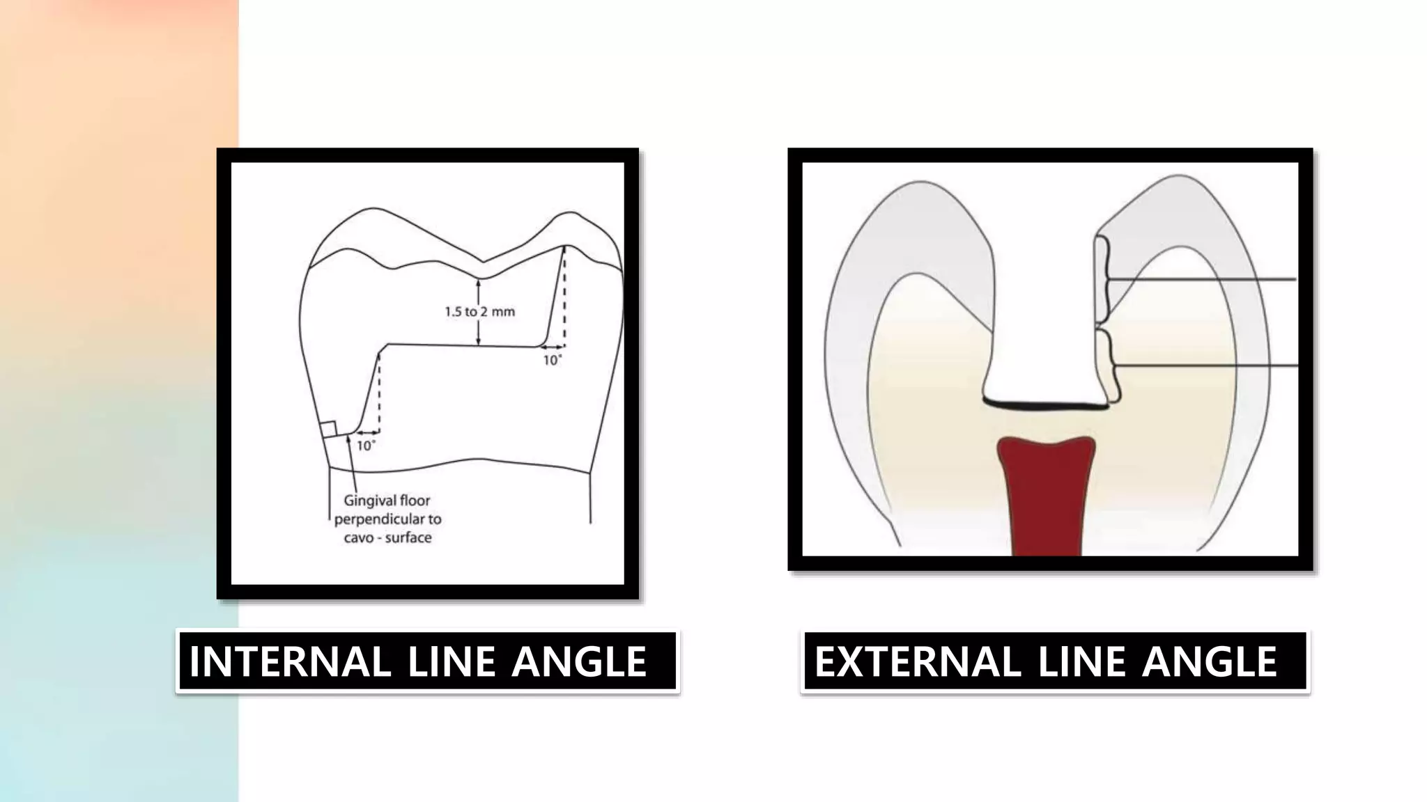 Fundamentals of Cavity preparation | PPTX