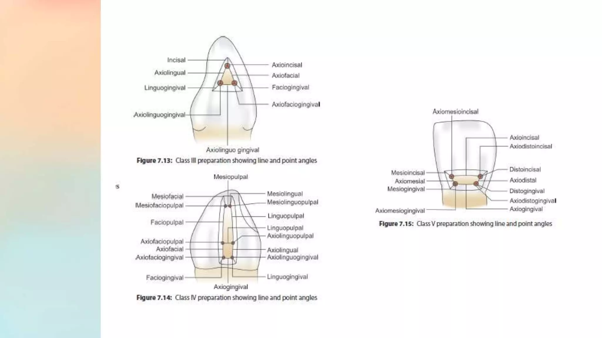 Fundamentals of Cavity preparation | PPTX