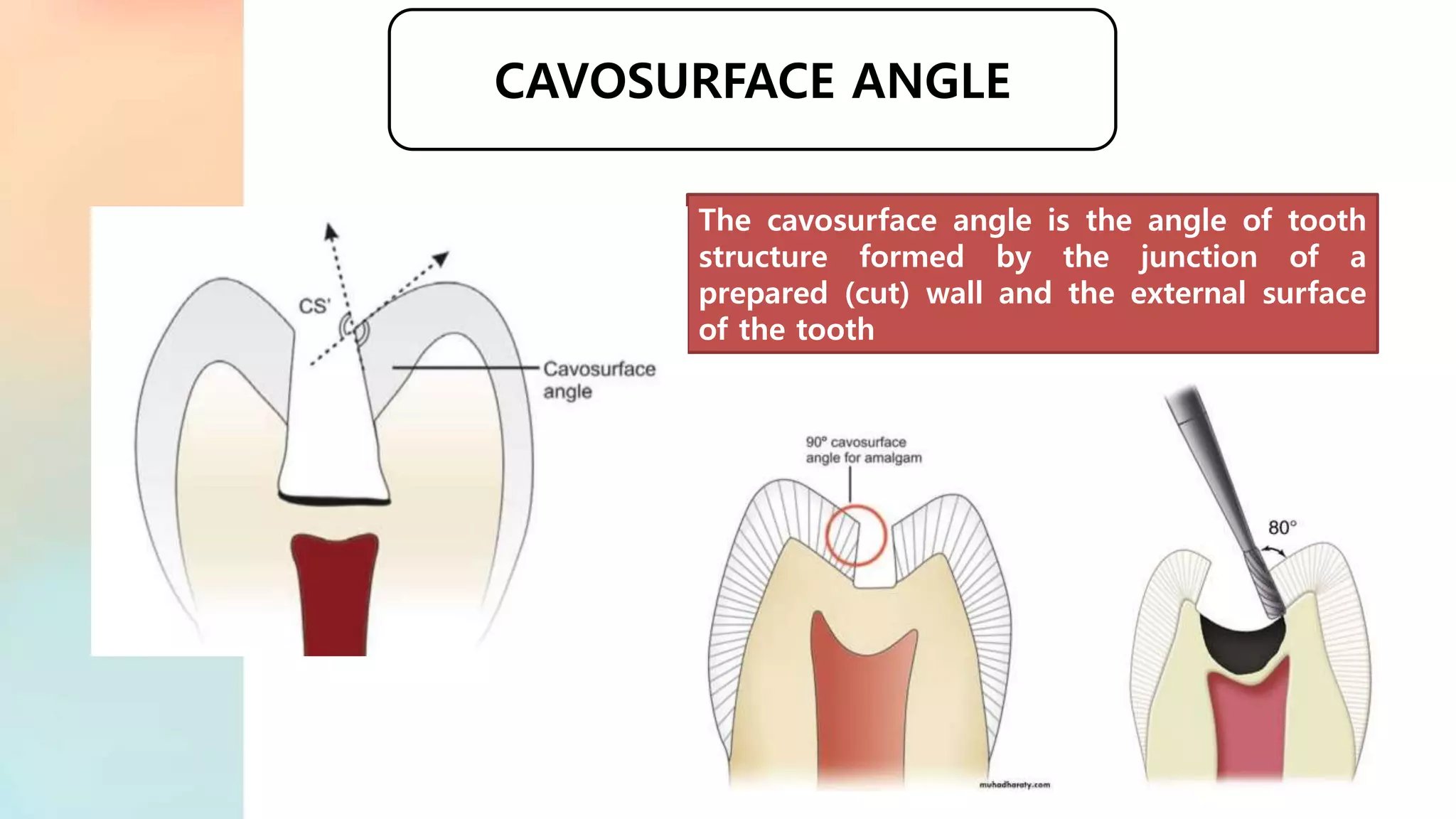 Fundamentals of Cavity preparation | PPTX