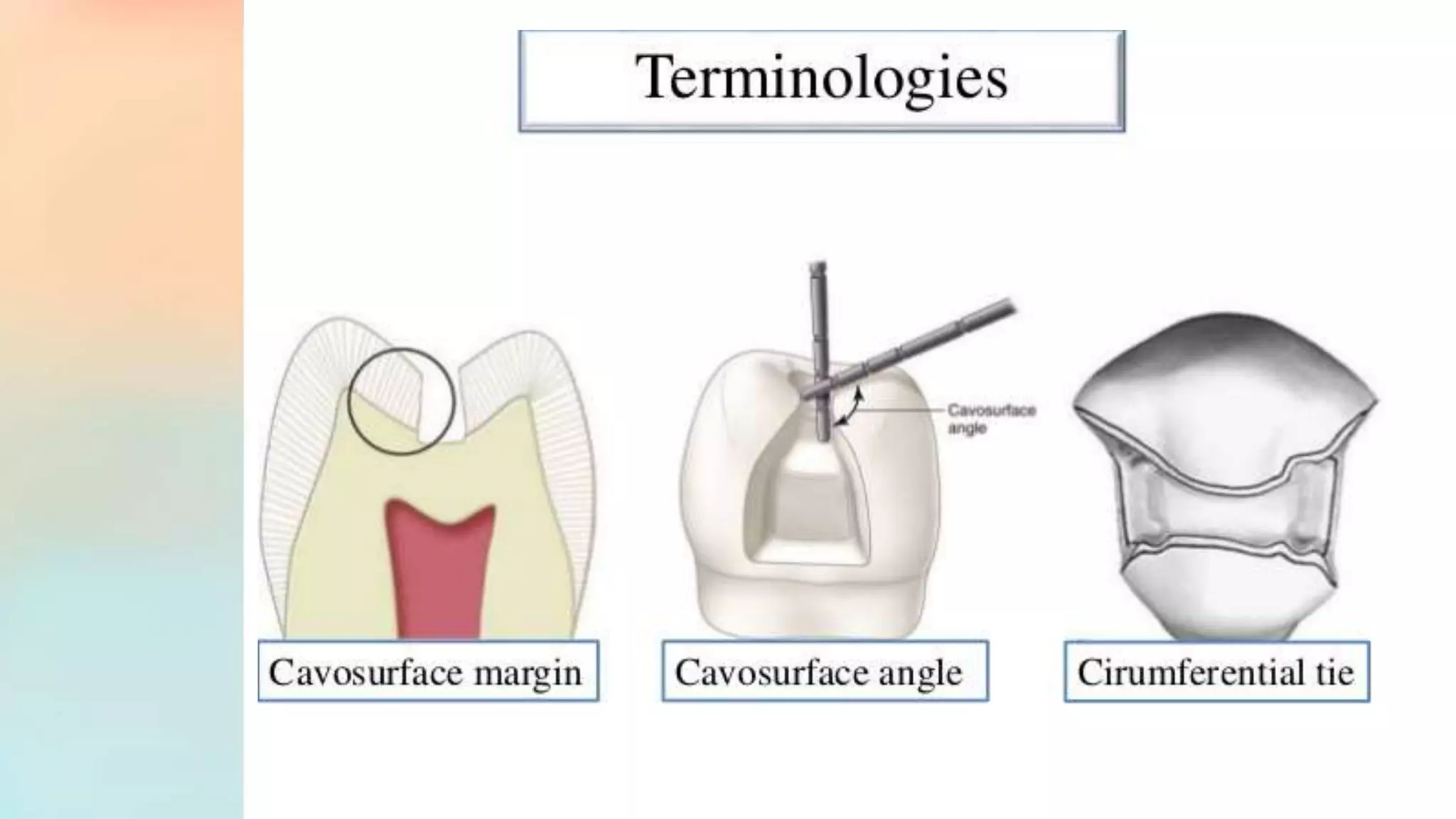 Fundamentals of Cavity preparation | PPTX