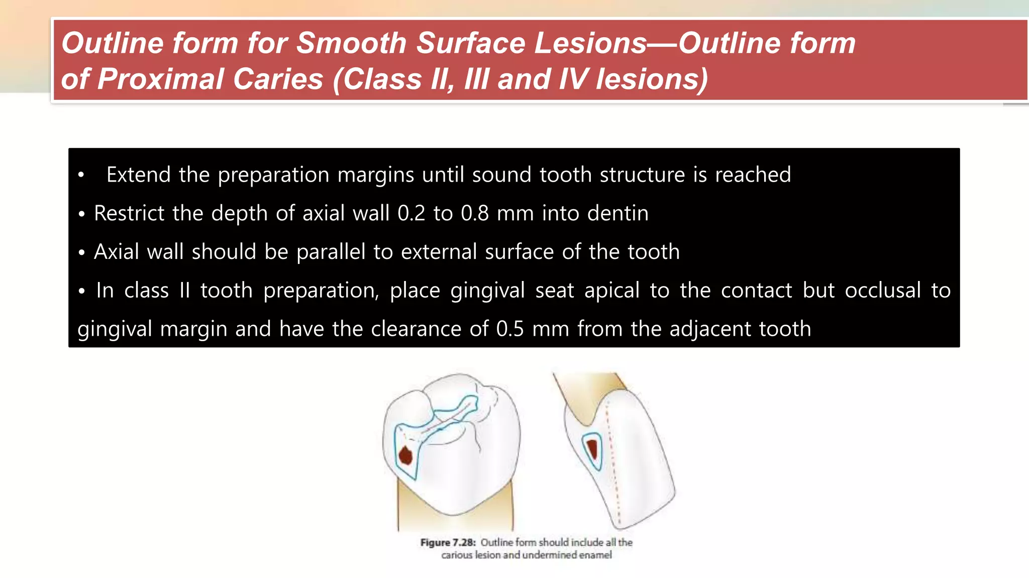 Fundamentals of Cavity preparation | PPTX