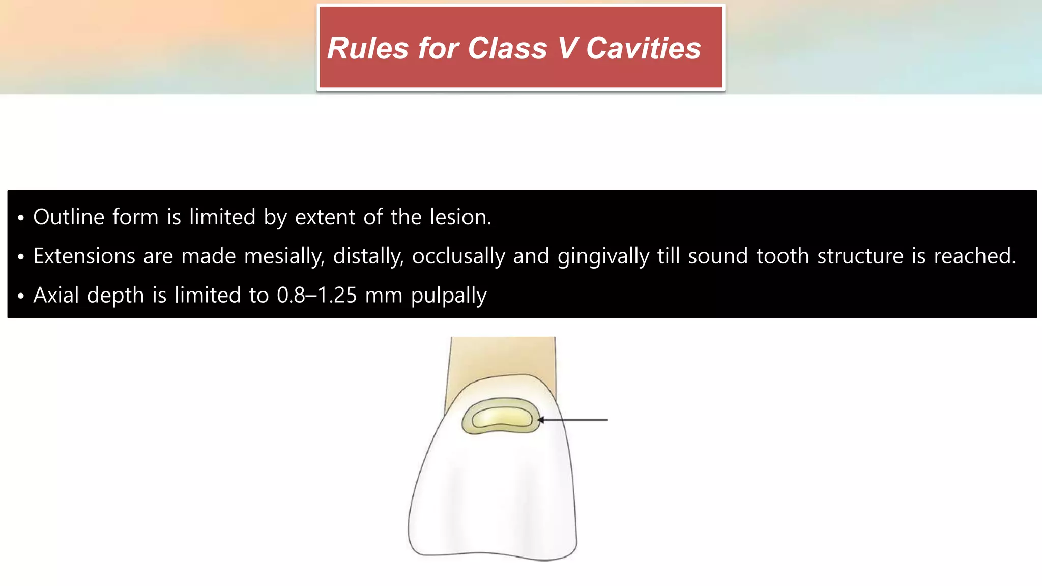 Fundamentals of Cavity preparation | PPTX