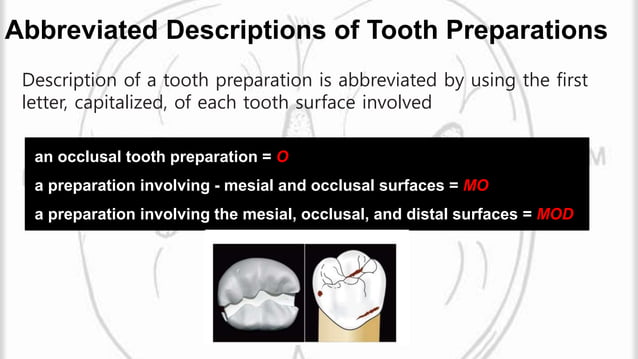 Fundamentals of Cavity preparation | PPTX | Dental Health | Diseases ...