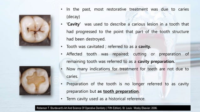 Fundamentals of Cavity preparation | PPTX | Dental Health | Diseases ...