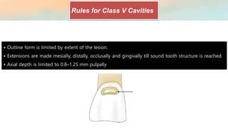 Fundamentals of Cavity preparation | PPTX