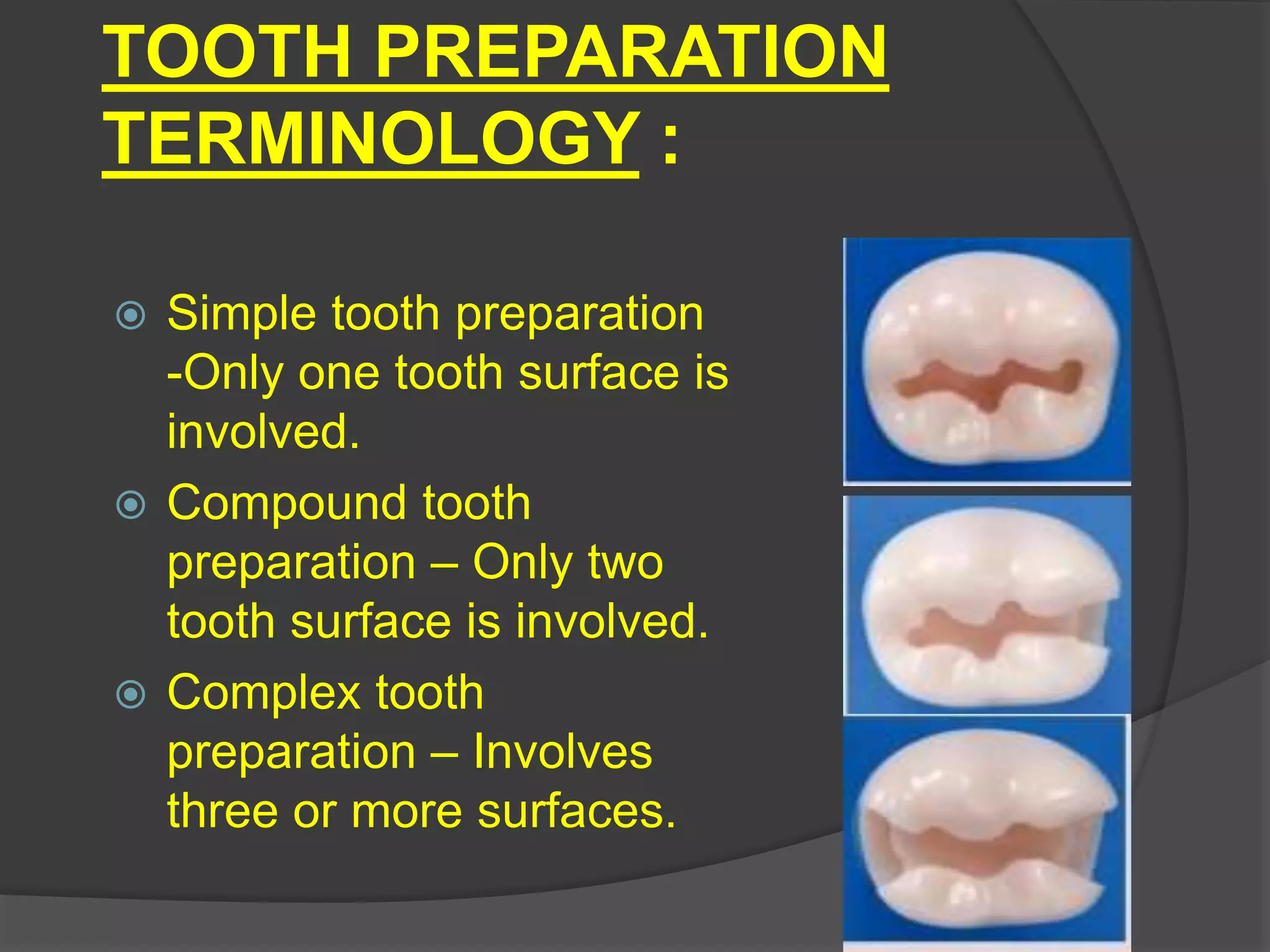 FUNDAMENTALS OF TOOTH PREPARATION.pptx