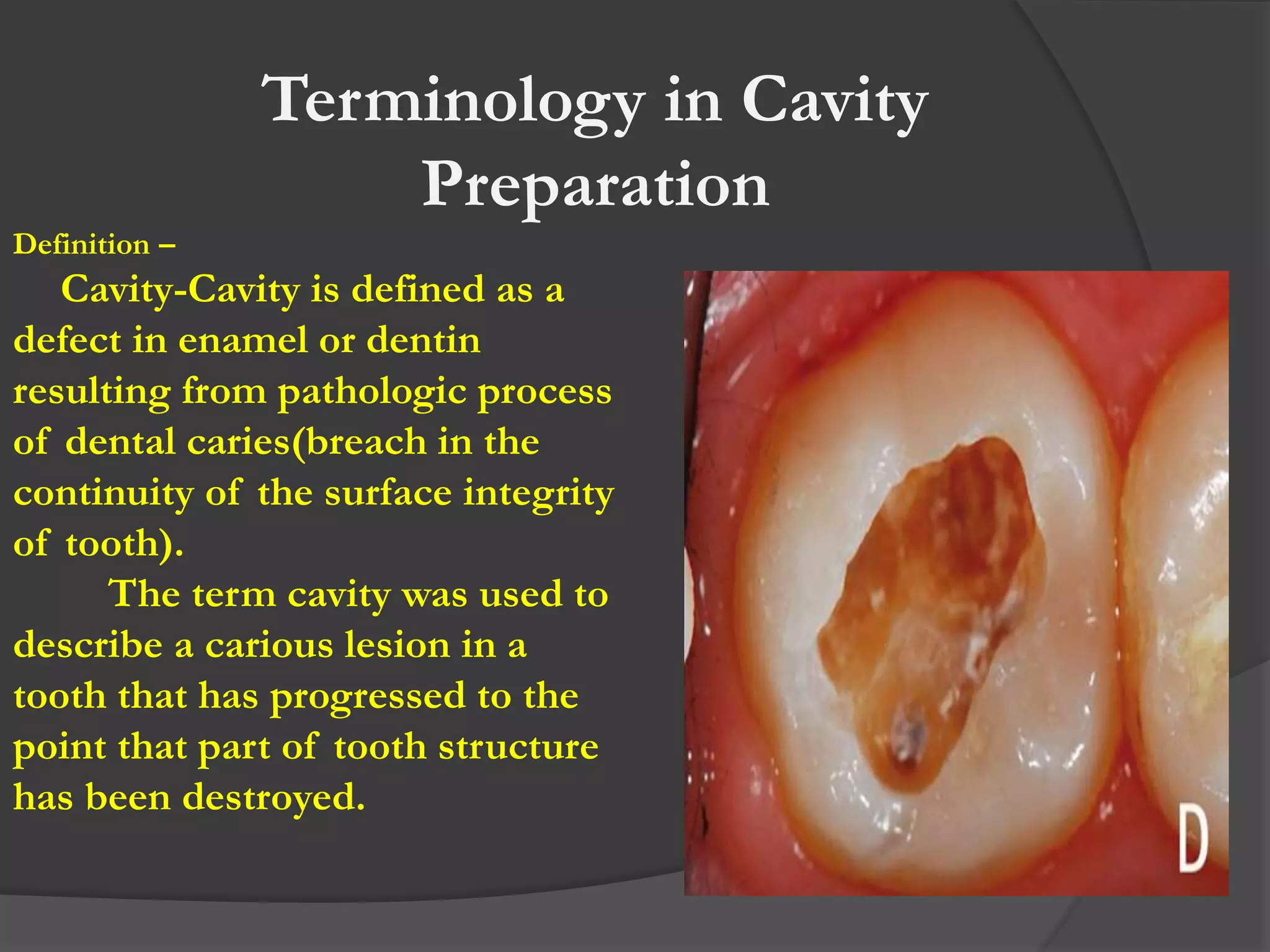FUNDAMENTALS OF TOOTH PREPARATION.pptx