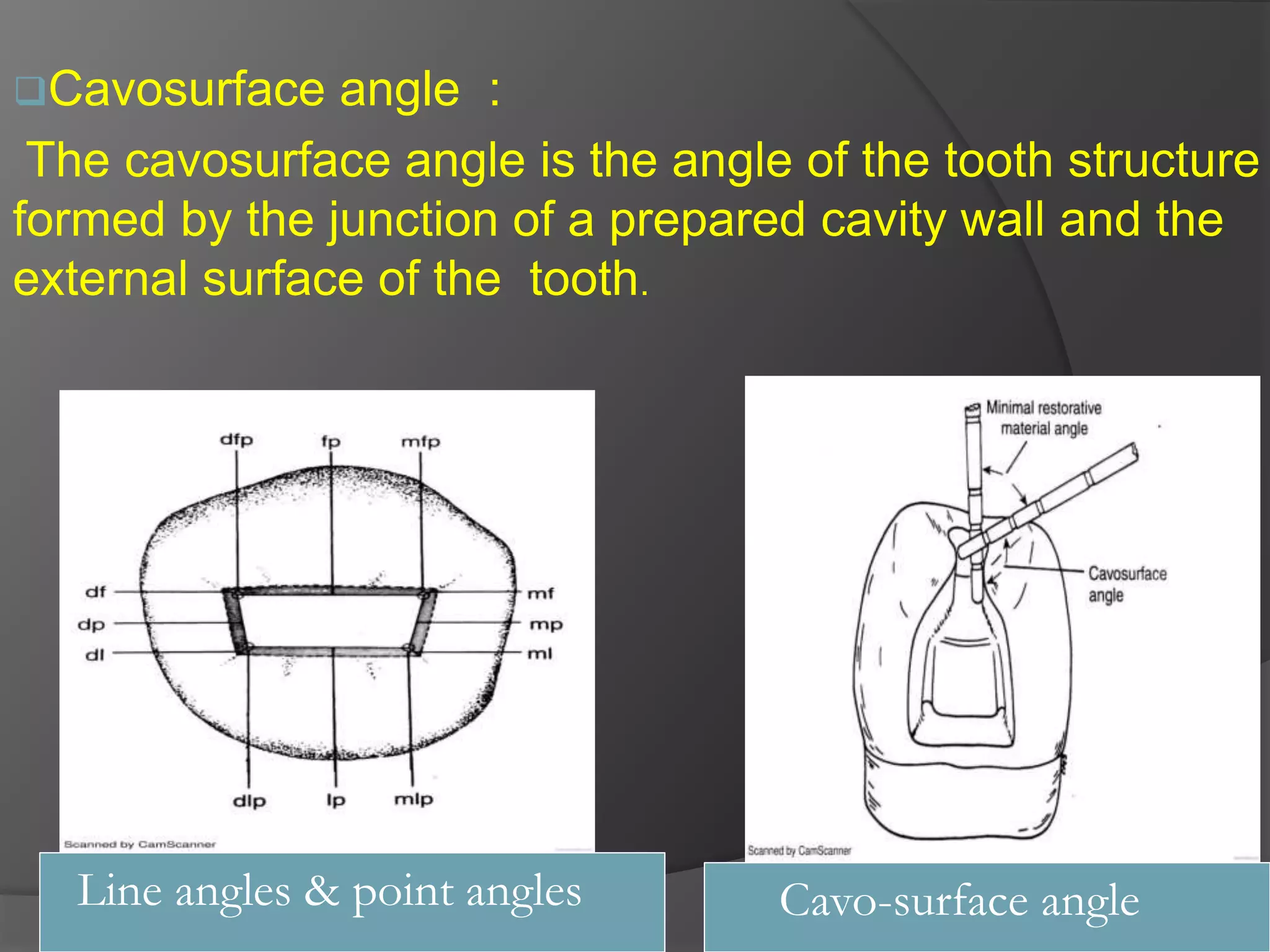 FUNDAMENTALS OF TOOTH PREPARATION.pptx