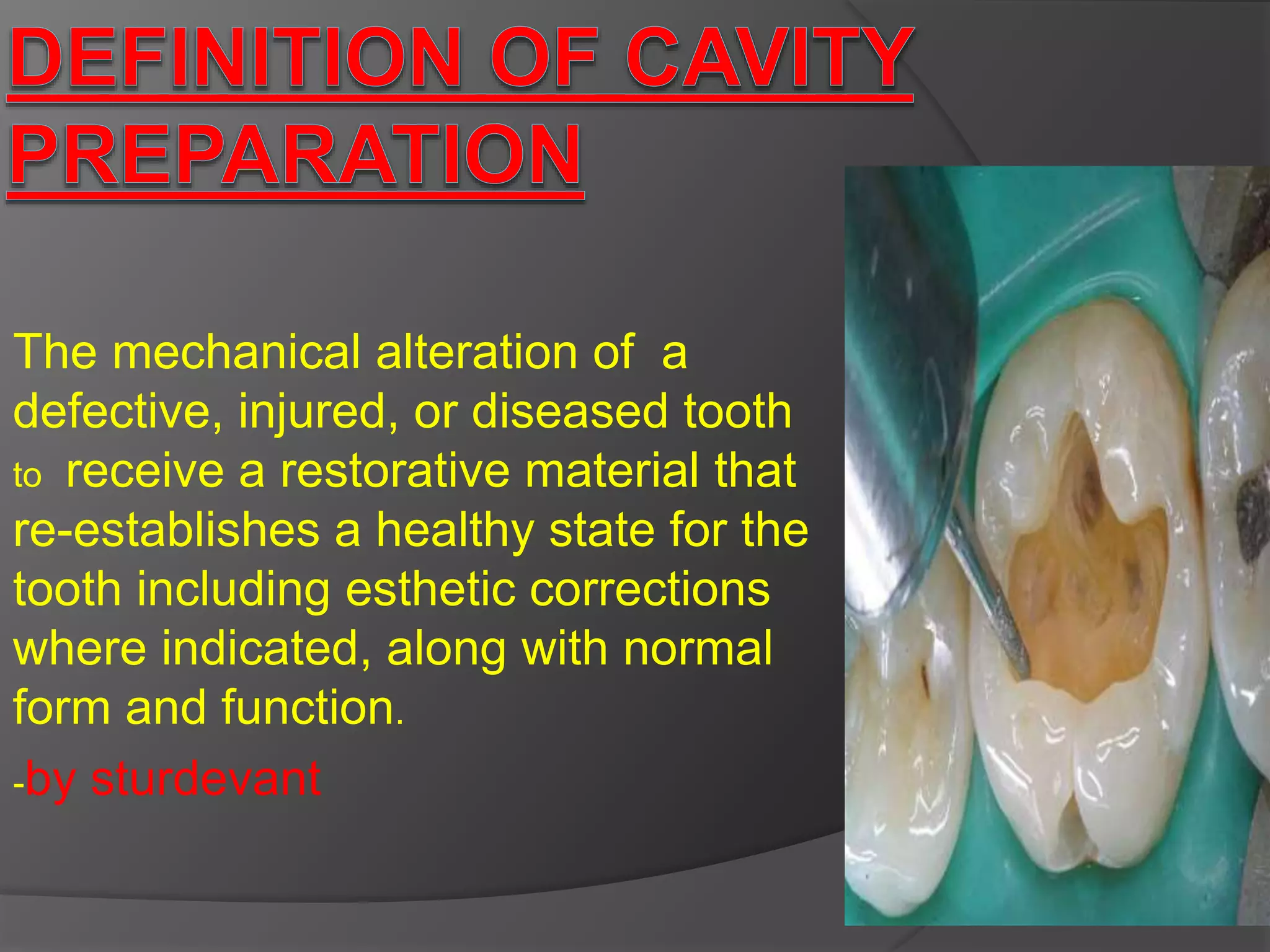 FUNDAMENTALS OF TOOTH PREPARATION.pptx