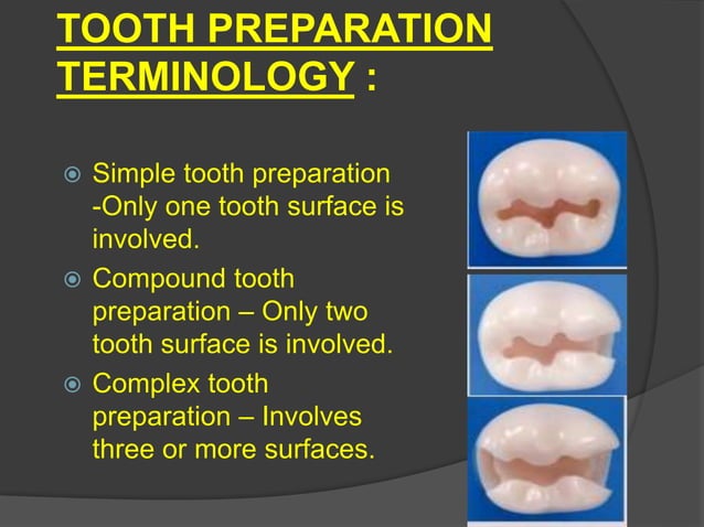 FUNDAMENTALS OF TOOTH PREPARATION.pptx