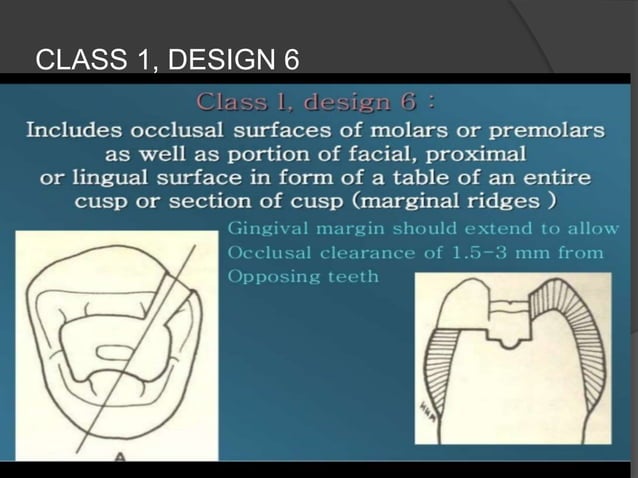 FUNDAMENTALS OF TOOTH PREPARATION.pptx