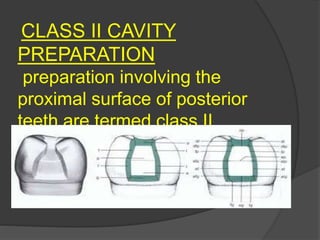 FUNDAMENTALS OF TOOTH PREPARATION.pptx